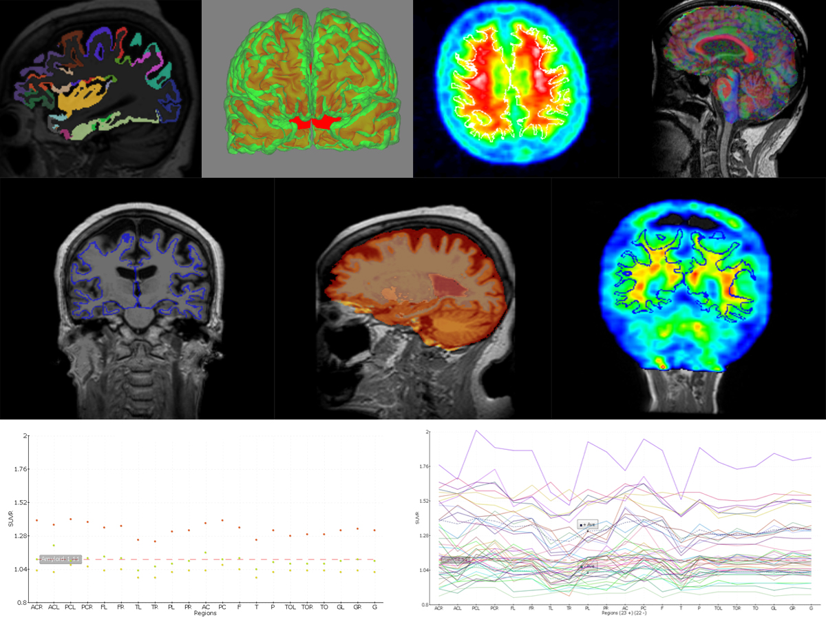 Neuroimaging Web Services Interface – Neuroimaging Web Services ...